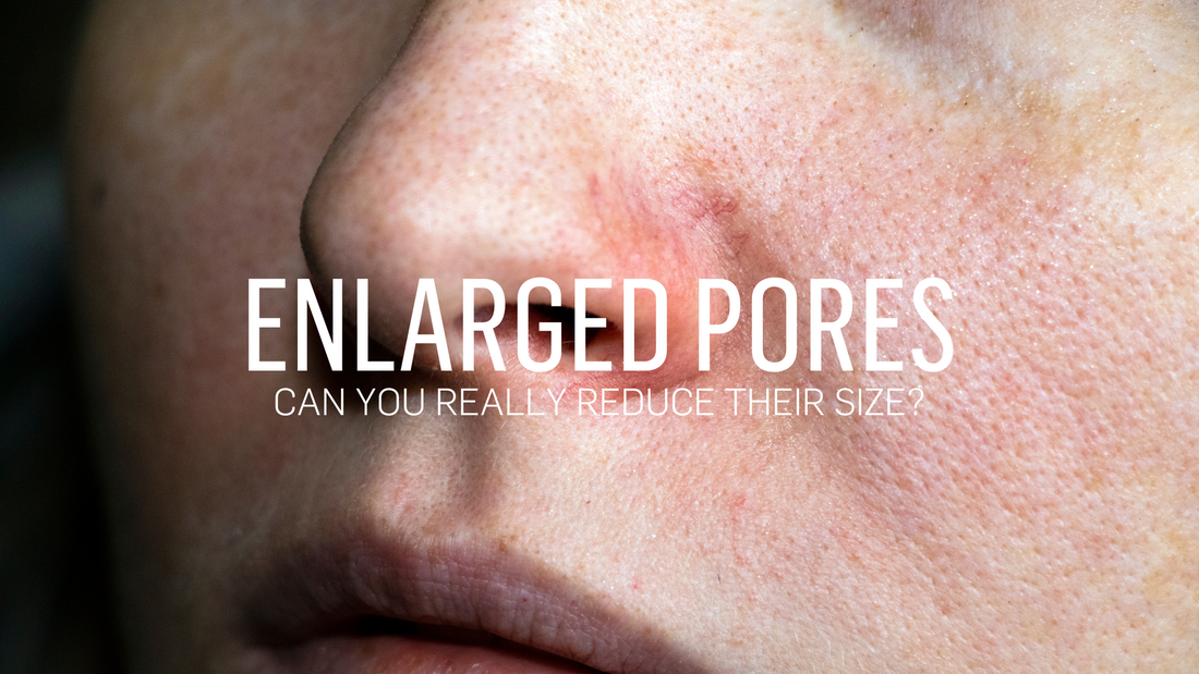 The Truth About Pores: Can You Really Reduce Their Size? – Kalaia